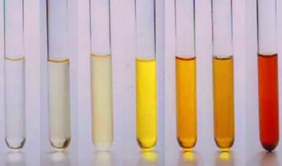 Šta nam govori boja mokraće? - PCNEN